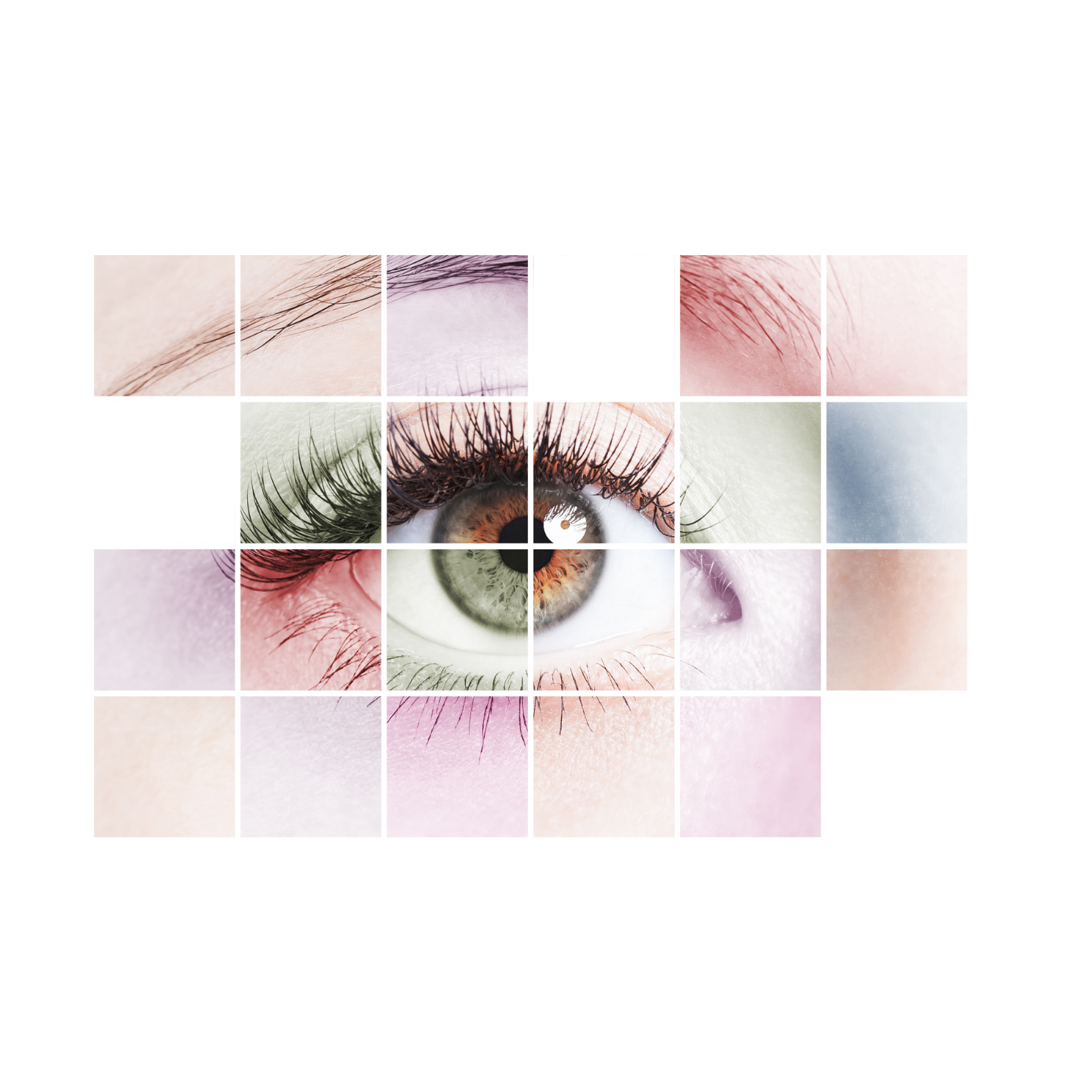 Exploring the Effects of Rejuran to Restore Firmness Around the Eyes ...