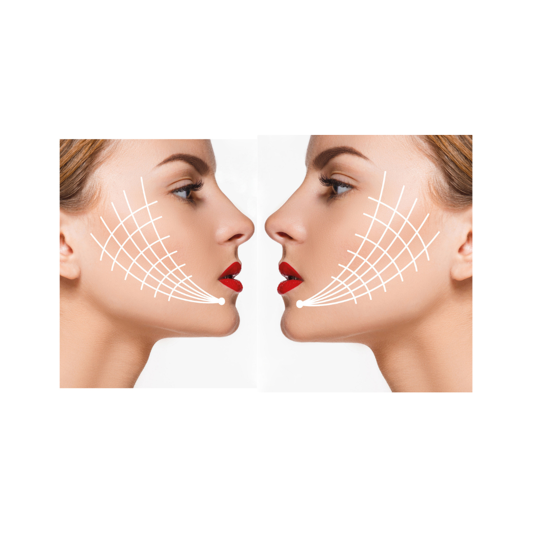 Understanding the Differences Between Thread Lifting and Shopping ...